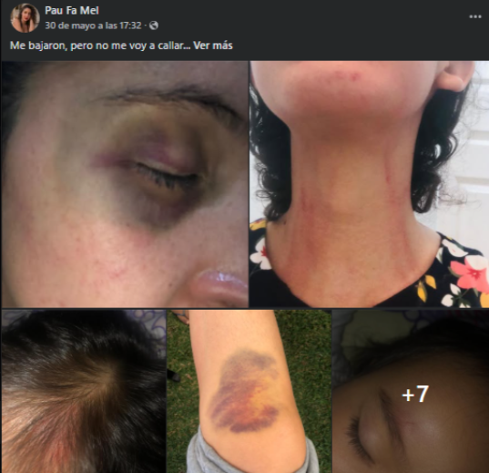 Mujer en Cuernavaca difunde vídeo de su expareja golpeándola, no ...